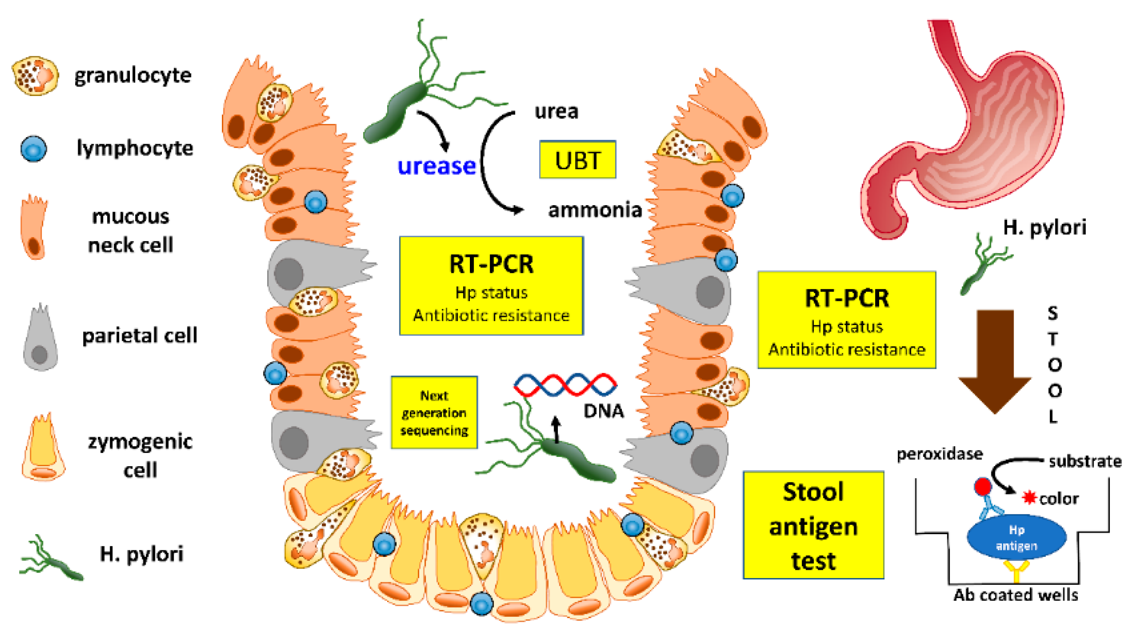 Helicobacter Pylori Detection Method Invasive Detection