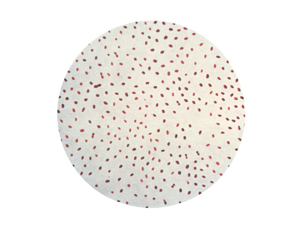 Overview of Brucellosis - Creative Diagnostics