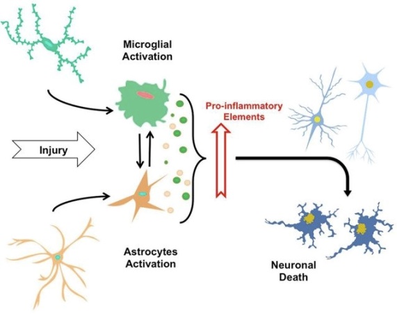 Neuroinflammation - Creative Diagnostics