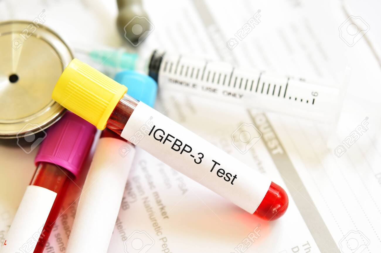 IGFBP-3 Antibodies and Antigens - Creative Diagnostics