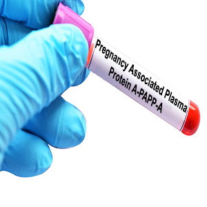 PAPP-A Antibodies and Antigens - Creative Diagnostics