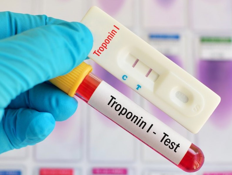 Trop I Test Cheap Offers | brunofuga.adv.br