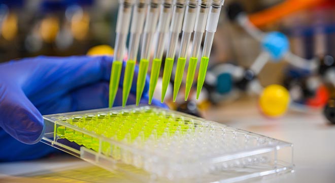 IVD Kits Development - Creative Diagnostics