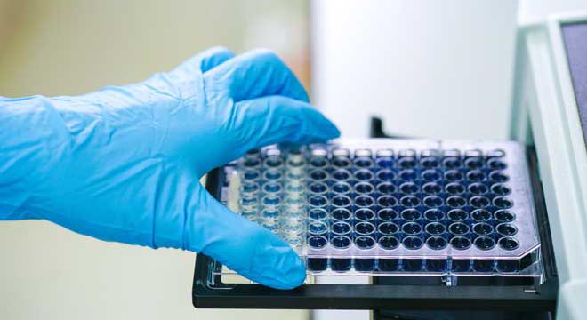 IVD Kits Development - Creative Diagnostics