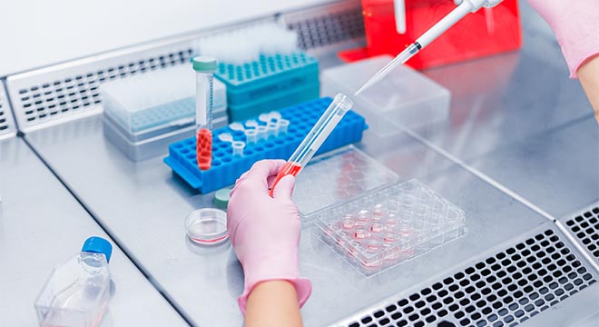 Test Service - Creative Diagnostics