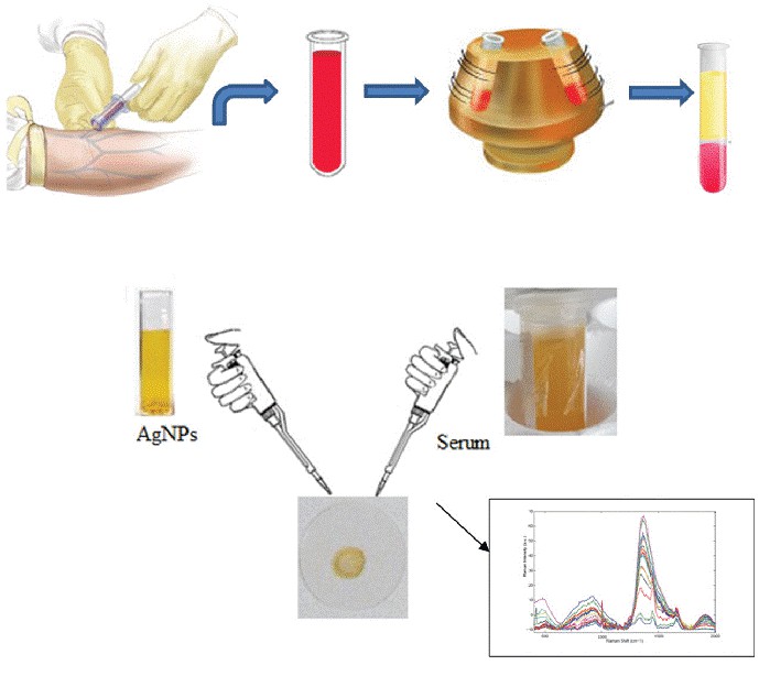 Serum Sample Preparation for ELISA - Creative Diagnostics