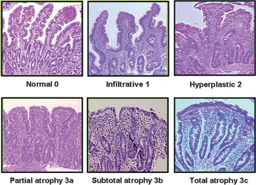 Anti-DGP IgA ELISA Kit (DEIA6111) - Creative Diagnostics