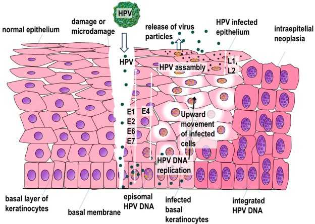 Recombinant Human Papilloma Virus type 33 L1 protein (VLP) (DAGF-232) - Creative Diagnostics
