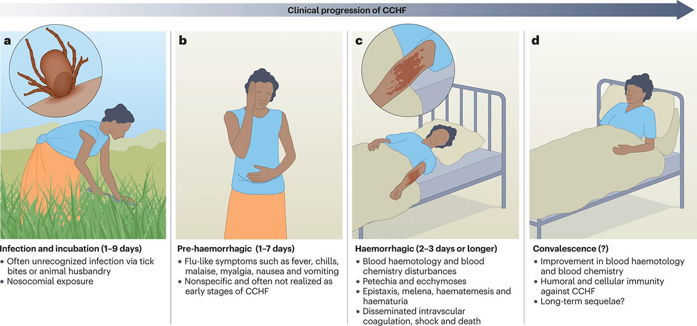 Recombinant CCHFV Nucleoprotein [His] (DAGA-3109) - Creative Diagnostics