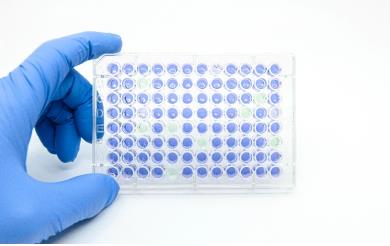 ELISA Recovery Rate - Creative Diagnostics