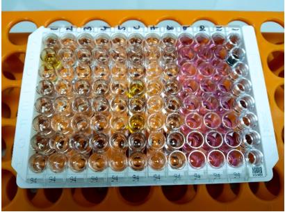 ELISA Sample Processing - Creative Diagnostics