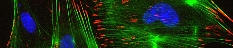Control Antibodies - Creative Diagnostics