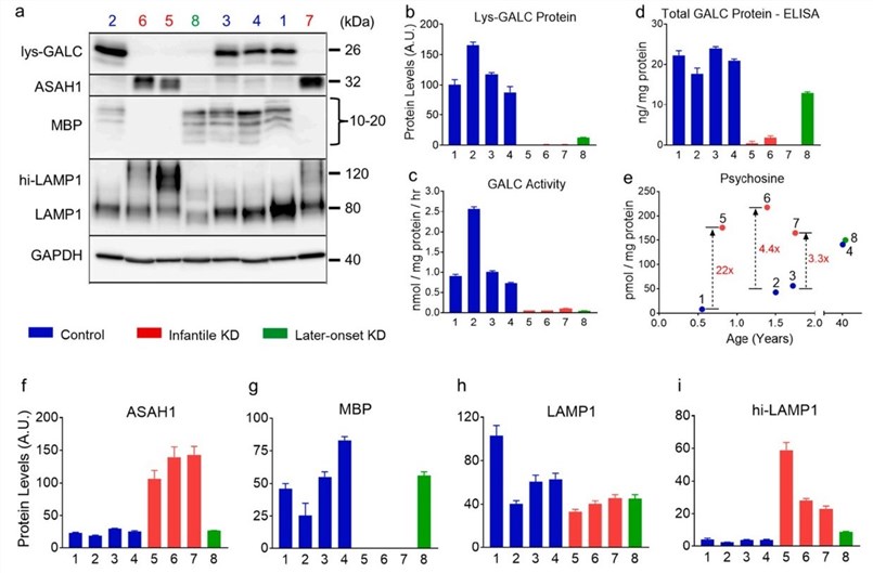 Galactosylceramidase and Krabbe Disease - Creative Diagnostics