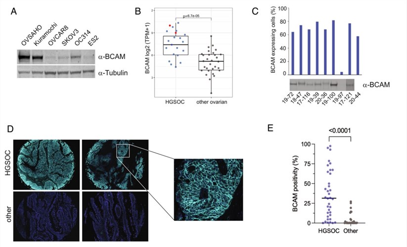 BCAM Gene and Ovarian Cancer - Creative Diagnostics