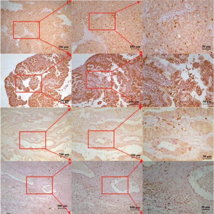 Expression of CD247 - Creative Diagnostics