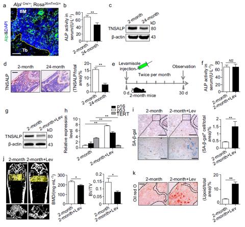 ALPL Gene and Bone Ageing - Creative Diagnostics