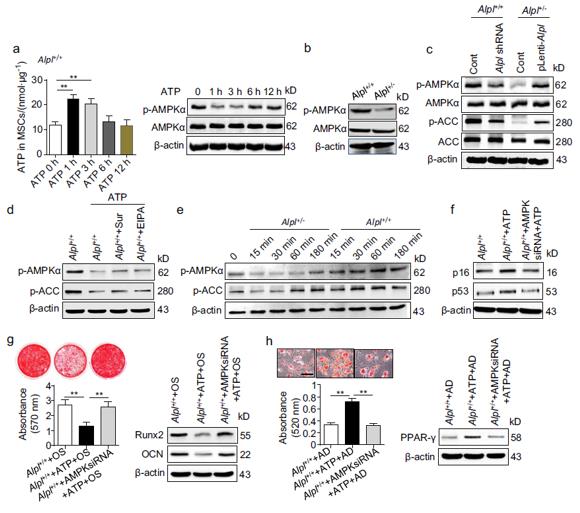 ALPL Gene and Bone Ageing - Creative Diagnostics