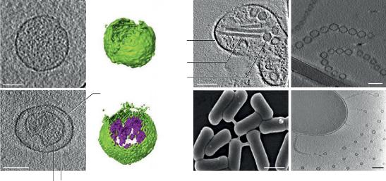Bacterial Membrane Vesicles Related Antibodies - Creative Diagnostics