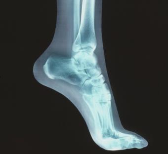 Bone - Creative Diagnostics