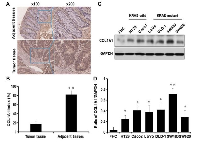 COL1A1 and Colorectal Cancer - Creative Diagnostics