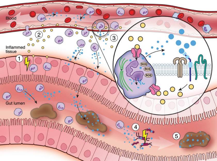 Calprotectin as a Biomarker of Inflammation Disease - Creative Diagnostics
