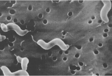 Campylobacter Jejuni Antigens - Creative Diagnostics