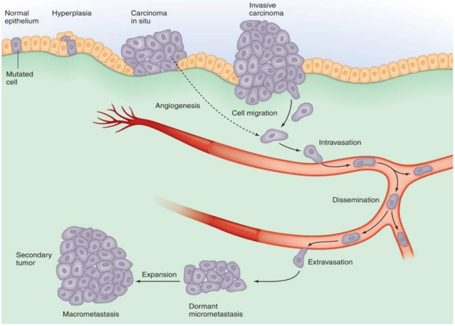Cancer Research - Creative Diagnostics