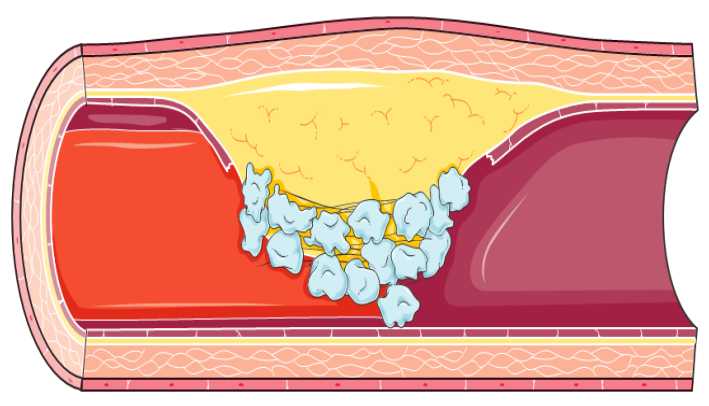 Cardiovascular and Inflammation - Creative Diagnostics