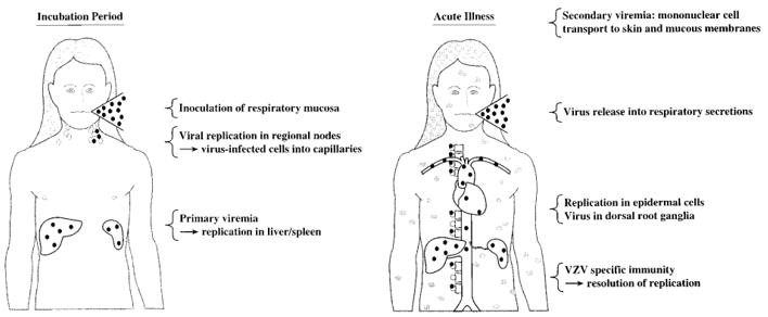 Childhood Diseases - Creative Diagnostics