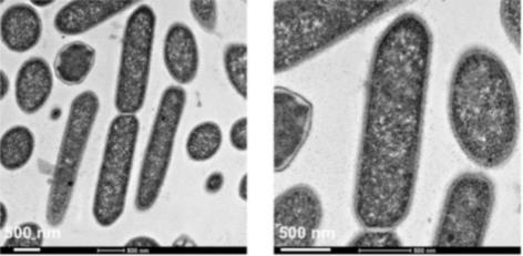 Clostridium Tetani Gram Stain
