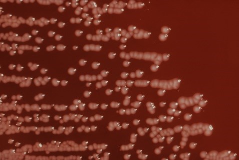 Yersinia Enterocolitica Antigens - Creative Diagnostics