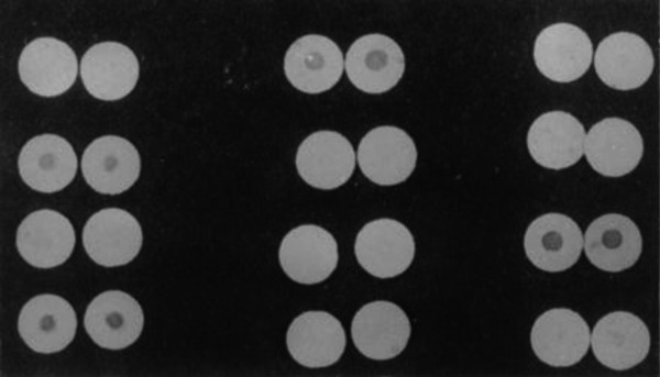 Dot-Immunobinding Assay (Dot-Iba) Protocol - Creative Diagnostics