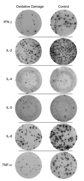 ELISPOT Assay as a Tool to Study Oxidative Stress in Lymphocytes ...