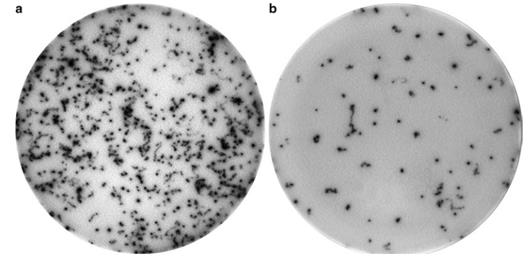 ELISPOT Protocol for Detection of TNFα Secreted by Microglia - Creative Diagnostics