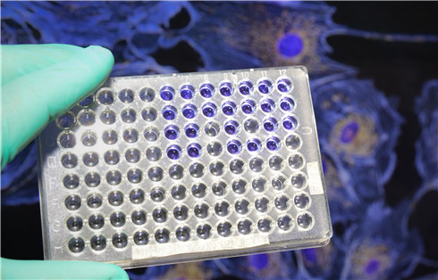 Protocol - Creative Diagnostics