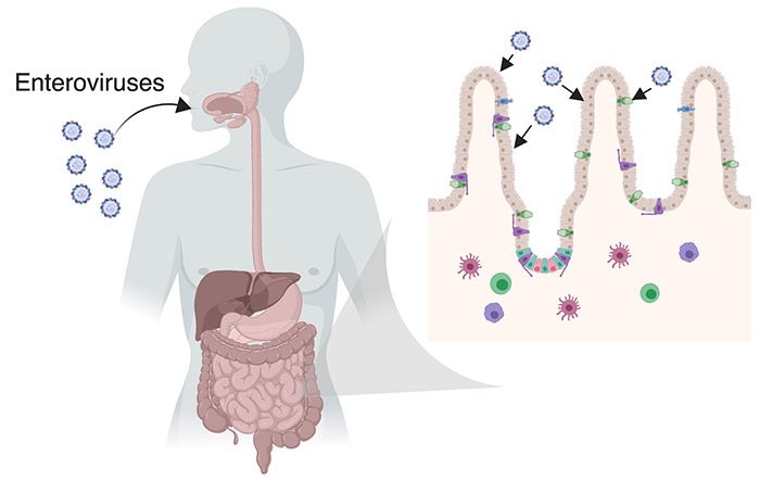 Enteroviruses - Creative Diagnostics