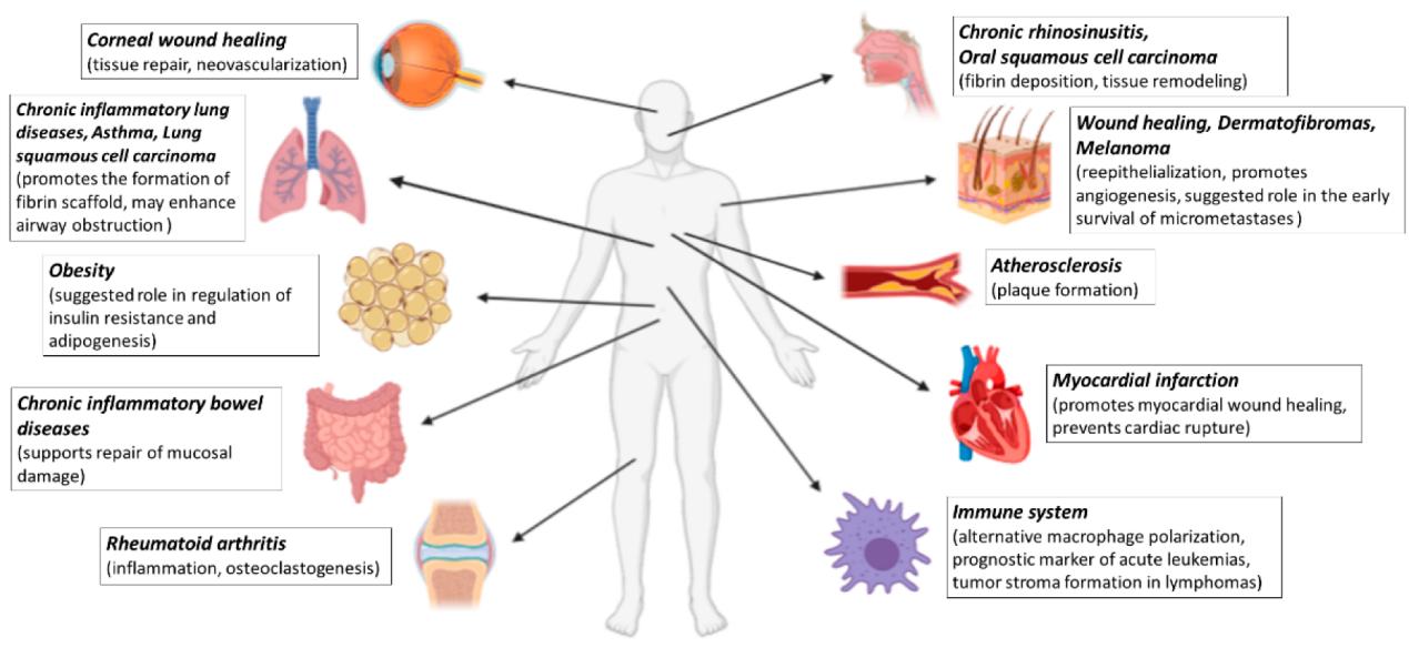 FXIIIα/F13A1: A Promising Therapeutic Target for Vascular Diseases ...