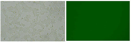 Human ACE2 Stable Cell Line - HEK293T - Creative Diagnostics