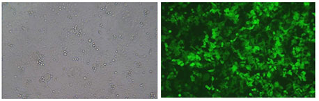 Human ACE2 Stable Cell Line - HEK293T - Creative Diagnostics