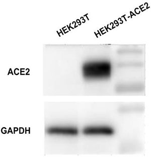 Human ACE2 Stable Cell Line - HEK293T - Creative Diagnostics