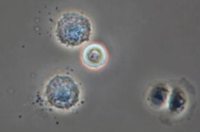 Immunocyte Markers - Creative Diagnostics