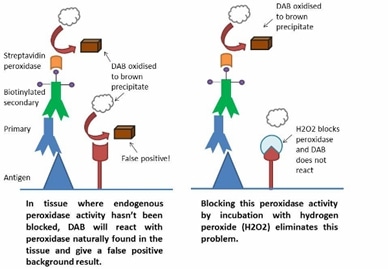 Immunohistochemistry (IHC) - Creative Diagnostics