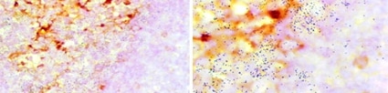 Immunohistochemistry (IHC) - Creative Diagnostics