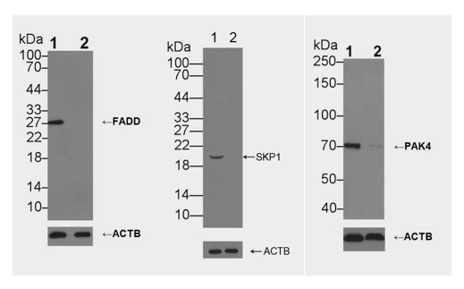 Knockout and Knockdown Validated Antibodies - Creative Diagnostics
