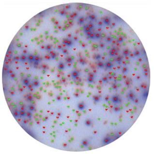 Mathematical Algorithms for Spotting in the ELISPOT Protocol - Creative ...
