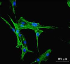 Mesenchymal Stem Cells - Creative Diagnostics