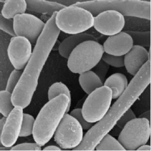 Candida Albicans Antigens - Creative Diagnostics