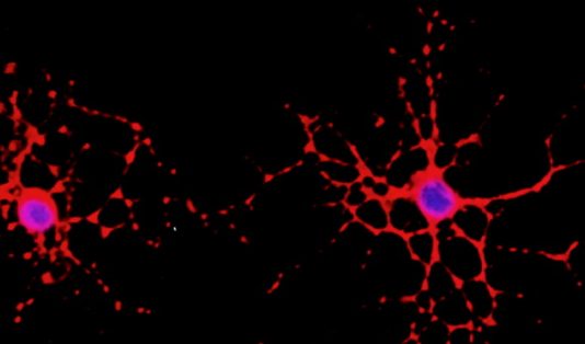 Neural Cells - Creative Diagnostics