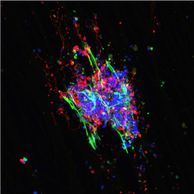 Neural Stem Cells - Creative Diagnostics