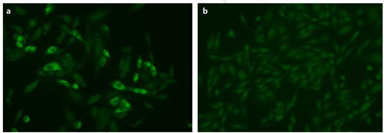 Phospholipase A2 receptor (PLA2R) and THSD7A stable cell line ...